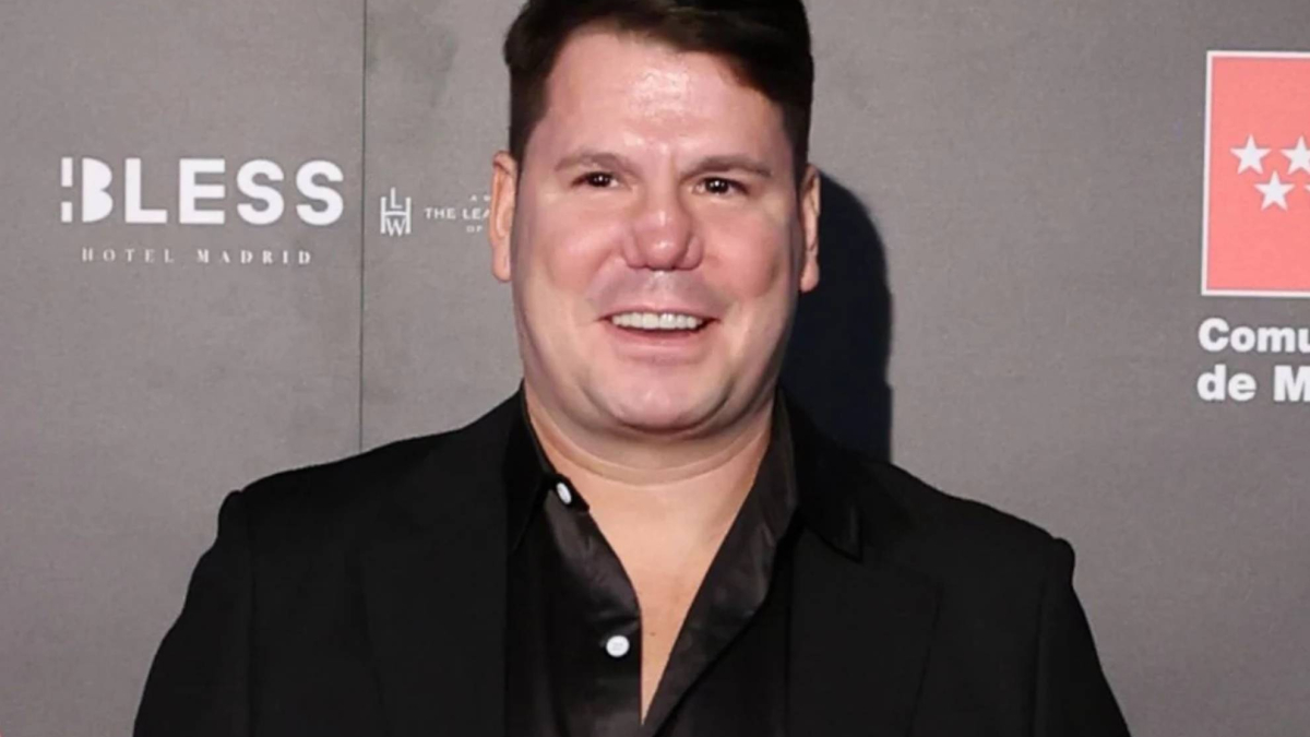 Lucas, de Andy y Lucas, reaparece y la nueva imagen de su nariz desata otra polémica: “Está mutando”