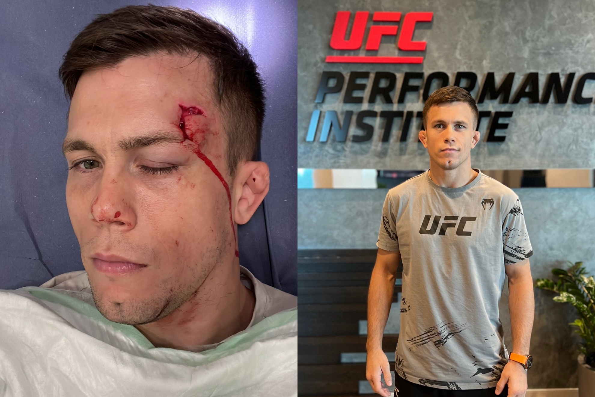 Así se produjo la despiadada agresión al luchador español de UFC Dani ...