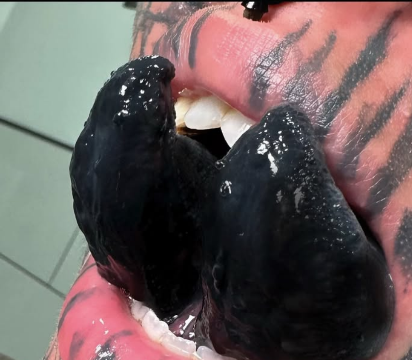 El antes y después de la tatuadora extrema: sin nariz (la guarda ...