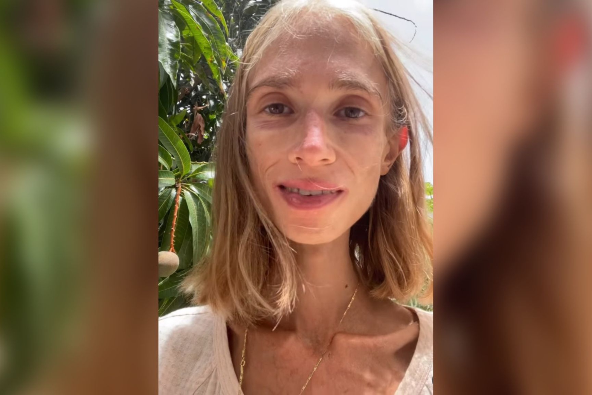 Esta es Karolina Kryzak: la joven vegana de 27 años que pesaba 22 kilos ...