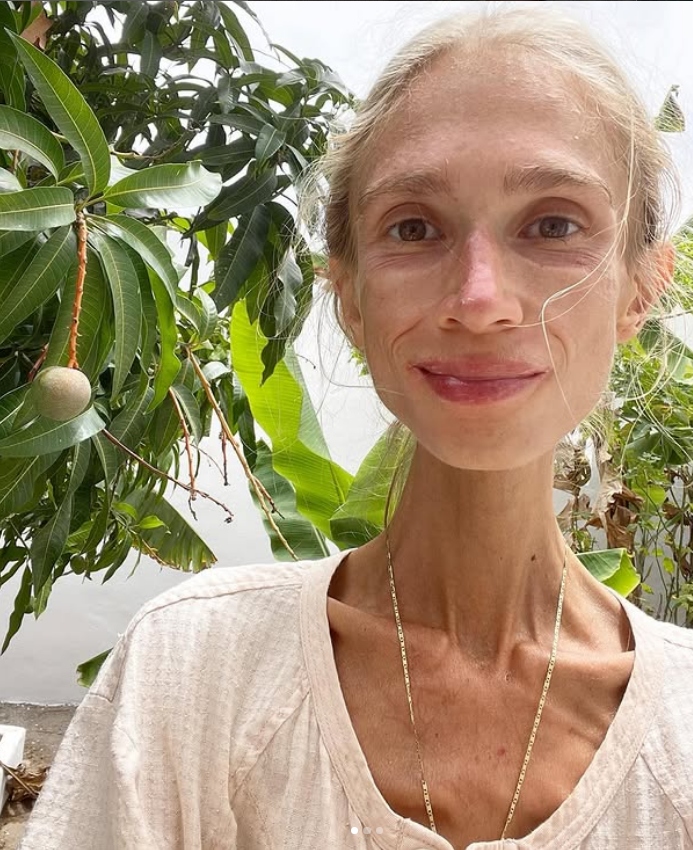 Esta es Karolina Kryzak: la joven vegana de 27 años que pesaba 22 kilos ...