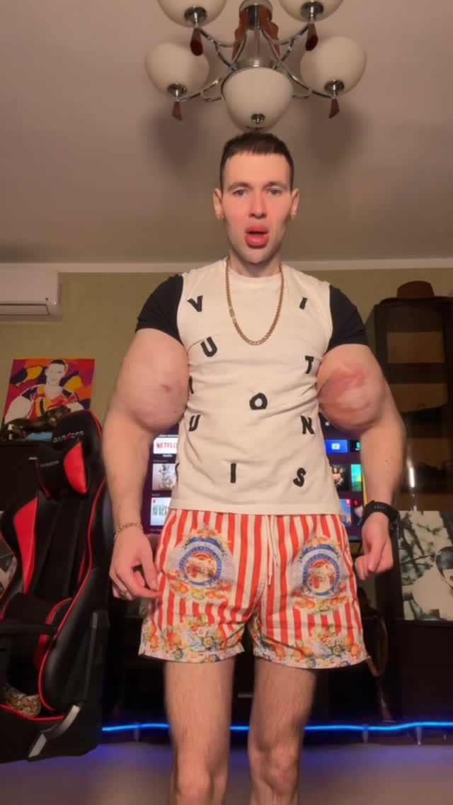 El 'Popeye ruso' podría quedarse sin brazos por inyectarse synthol