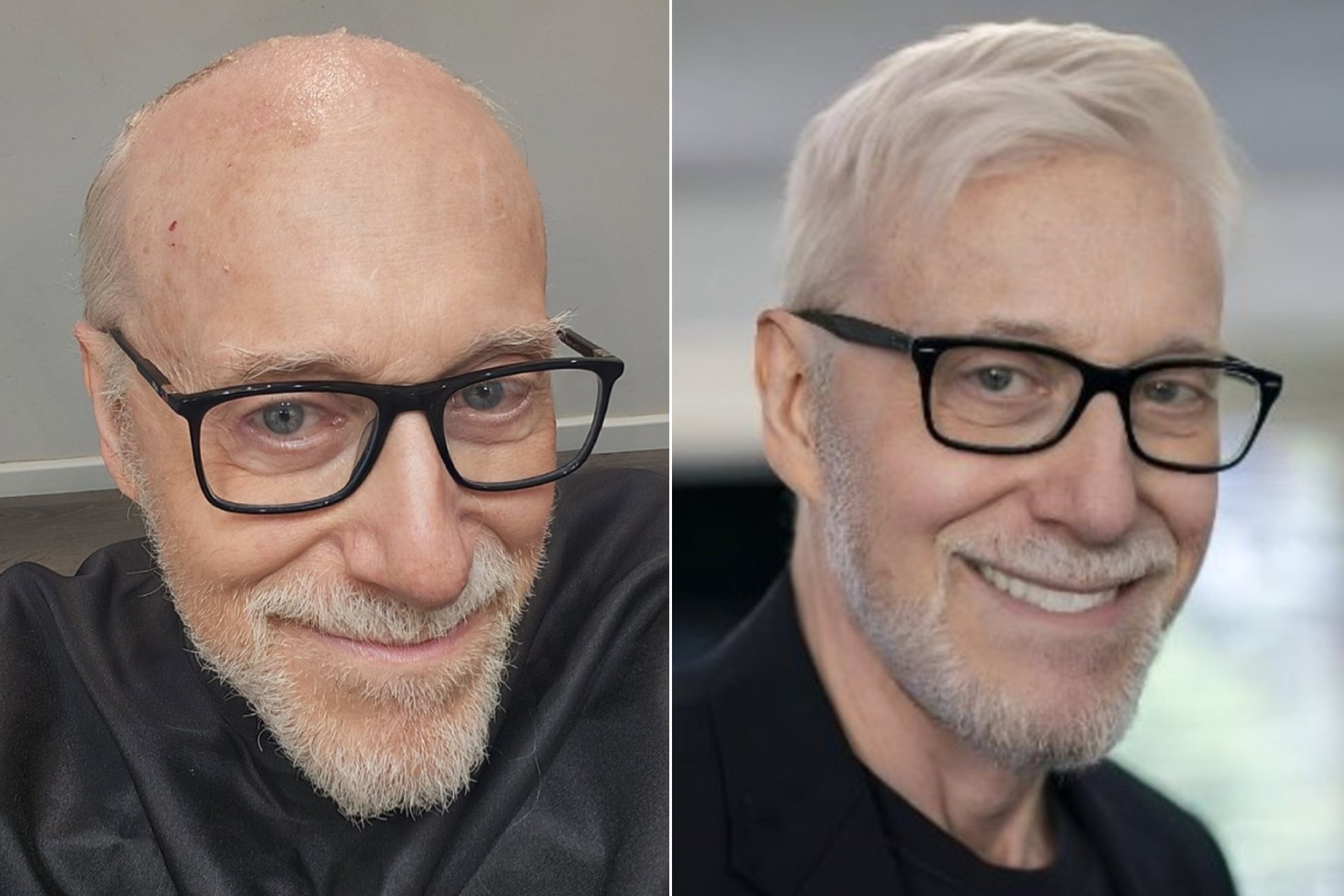 El polémico tratamiento de Josep María Mainat para mantenerse joven con ...