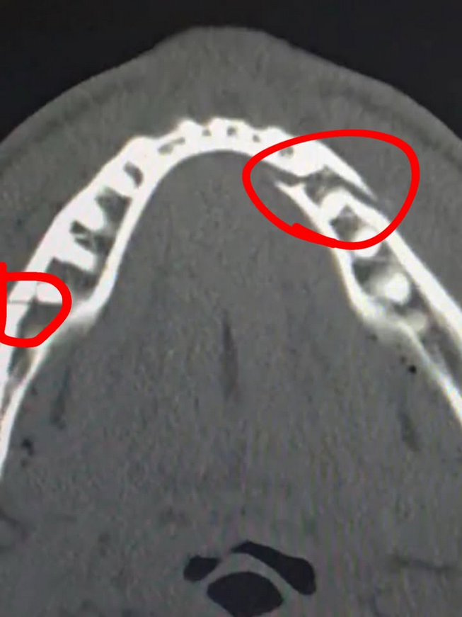 Jake Paul presume del "fracaso" de su "sueño americano": la mandíbula ...